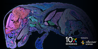 Xenium makes high-performance in situ easy: From simple workflow to ...