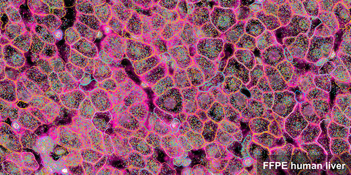 Xenium Prime 5k Assays | Millennium Science